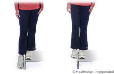 Hip Arthritis: Exercises | Kaiser Permanente