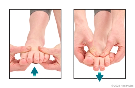 Foot Sprain (Metatarsophalangeal Joint): Rehab Exercises | Kaiser ...