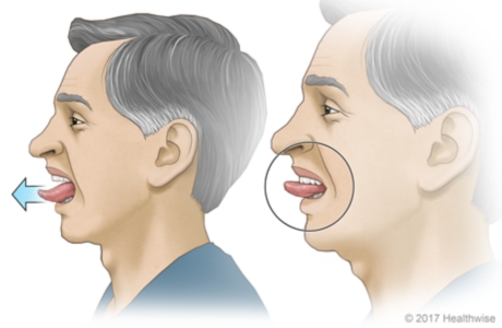 Deglución: Ejercicios | Kaiser Permanente