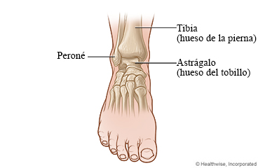 Fractura de tobillo: Instrucciones de cuidado | Kaiser Permanente